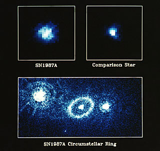 Supernova 1987A | ESA/Hubble